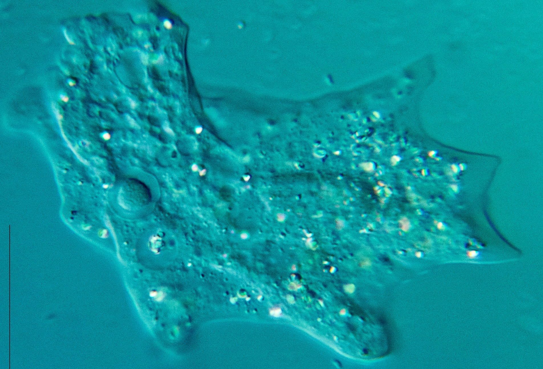 CadA shields help amoebae survive in more than one way