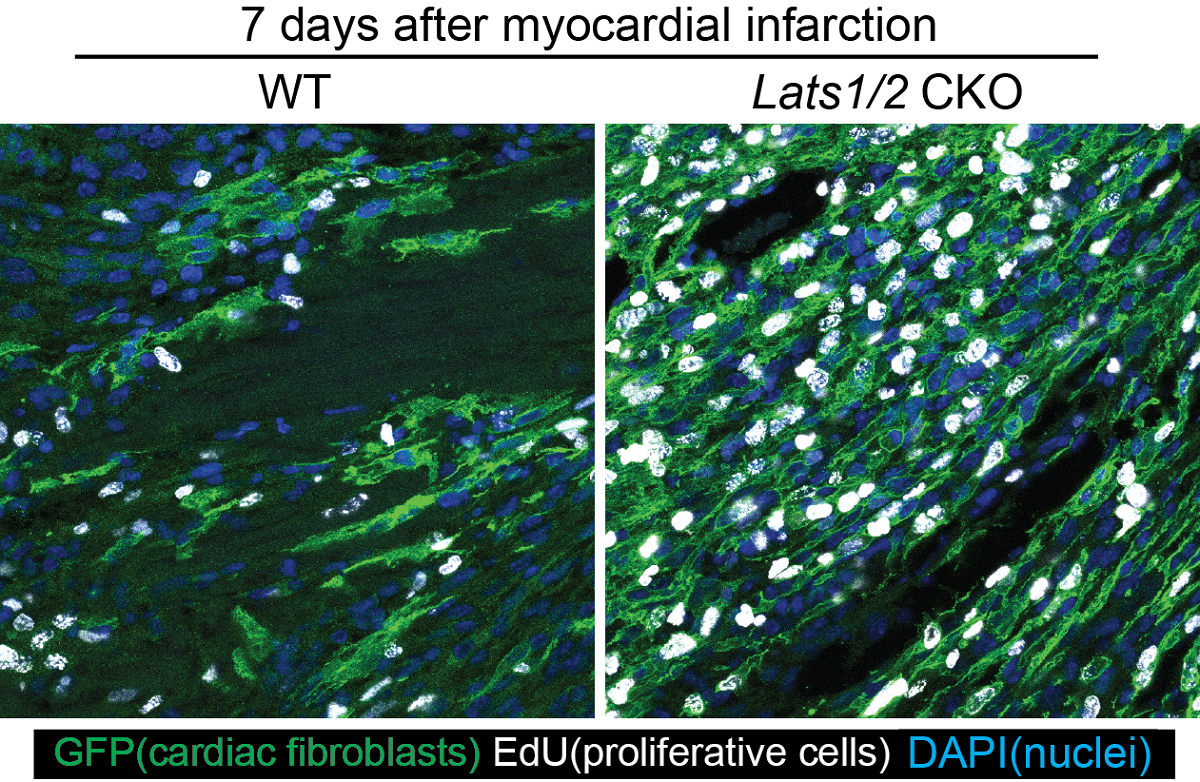 Image of the Month: cardiac fibroblasts