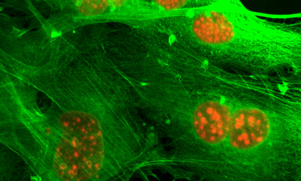 p53 mutant R273H opens new avenues for future personalized cancer treatment