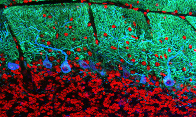Image of the Month: Cerebellar Purkinje cell