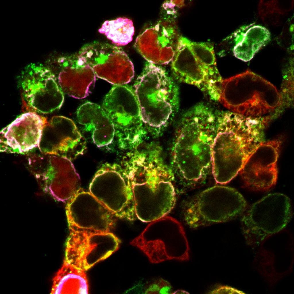 Life after weight loss surgery: Gaining a new perspective