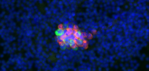 cluster cancer cells Archives - Baylor College of Medicine Blog Network