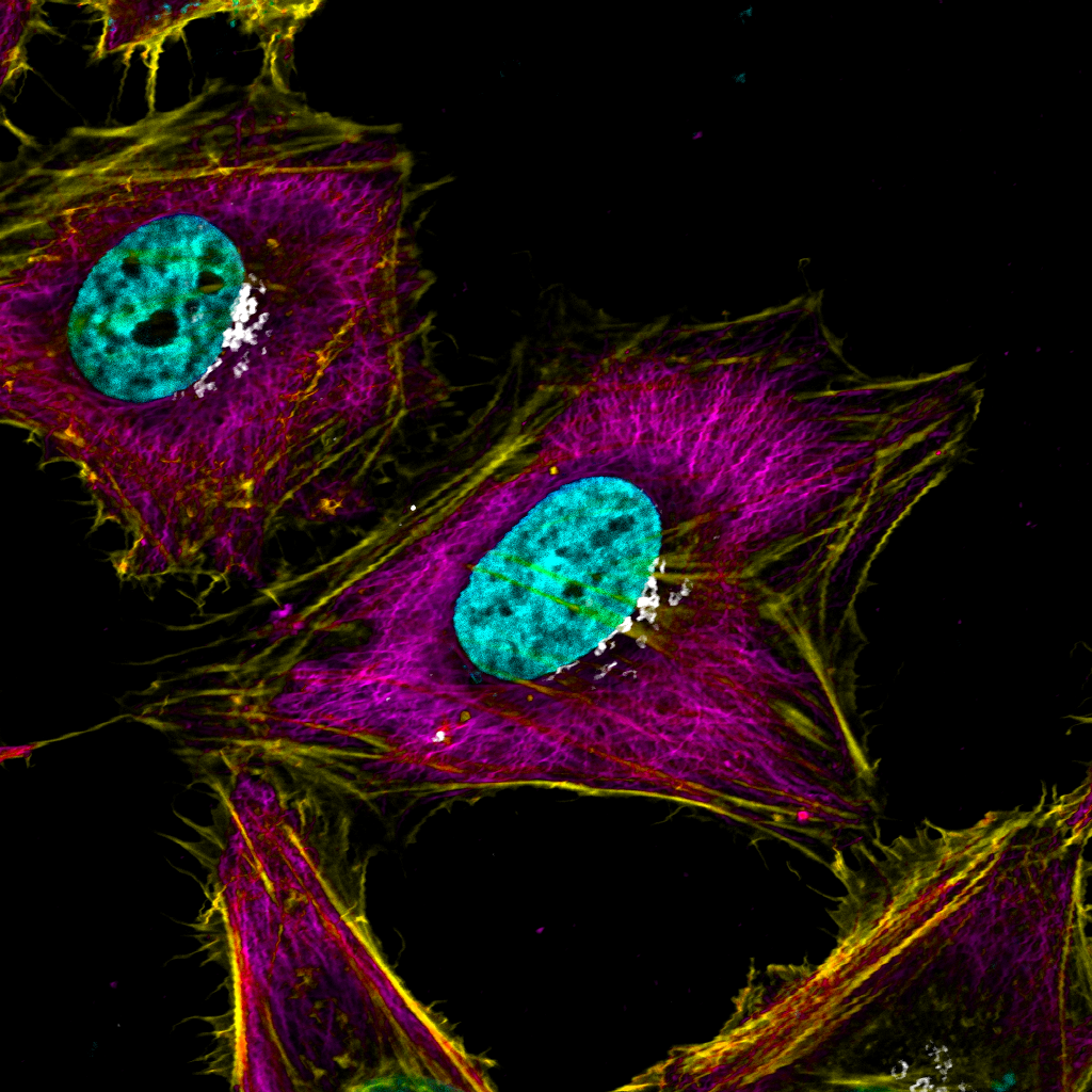 Image of the Month: Hues of HeLa