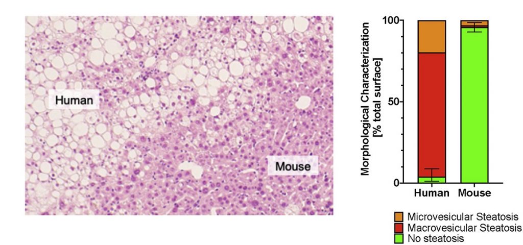 Closer to human – mouse model more accurately reproduces fatty liver ...