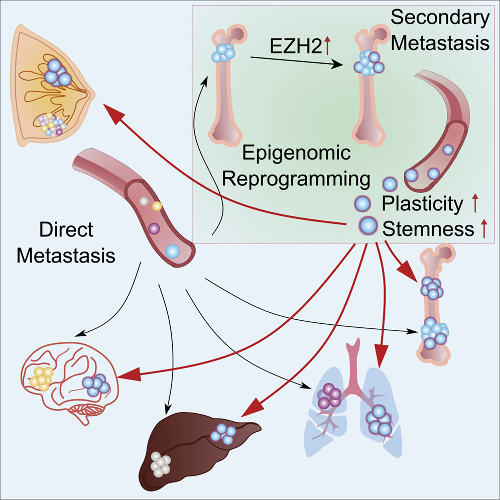 The bone microenvironment ‘empowers’ cancer cells to become metastatic