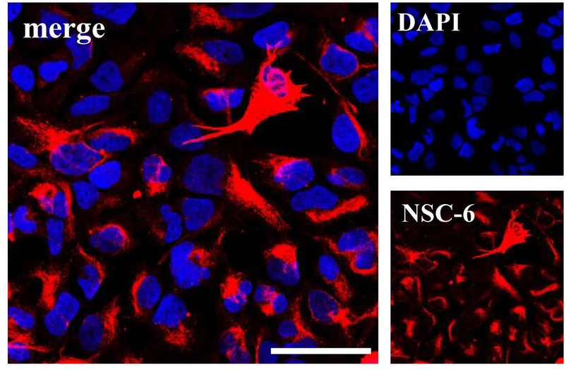 Novel marker identifies cells that generate new neurons throughout life ...