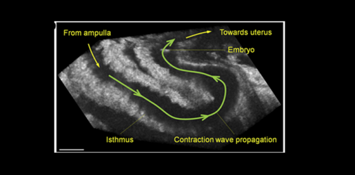 How the egg and the embryo actually travel through the fallopian tube