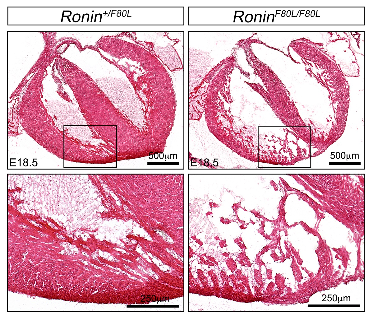 Unraveling the complexity of vitamin B12 diseases
