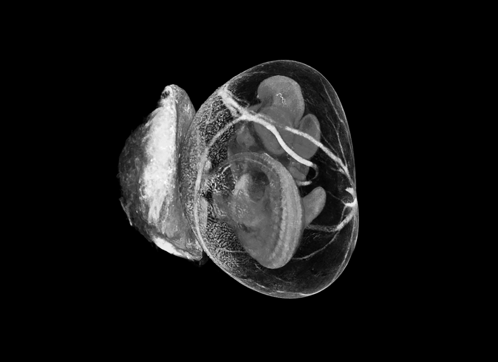 Image of the Month: Mouse embryo inside the yolk sac