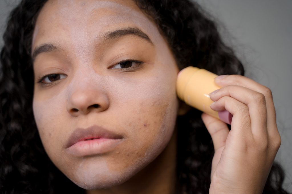Facts and misconceptions about acne - Baylor College of Medicine Blog ...
