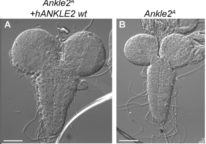 Comprehensive clinical study confirms the molecular link between ...
