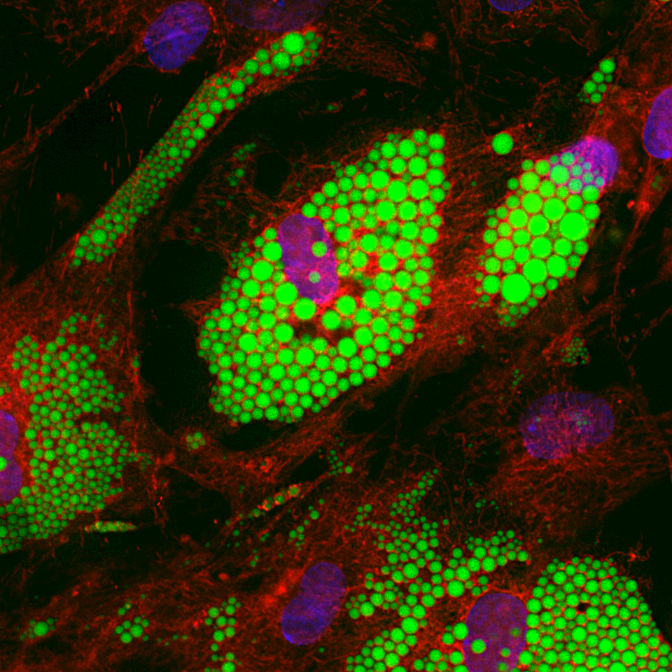 Findings support repurposing rheumatoid arthritis drug auranofin for ...