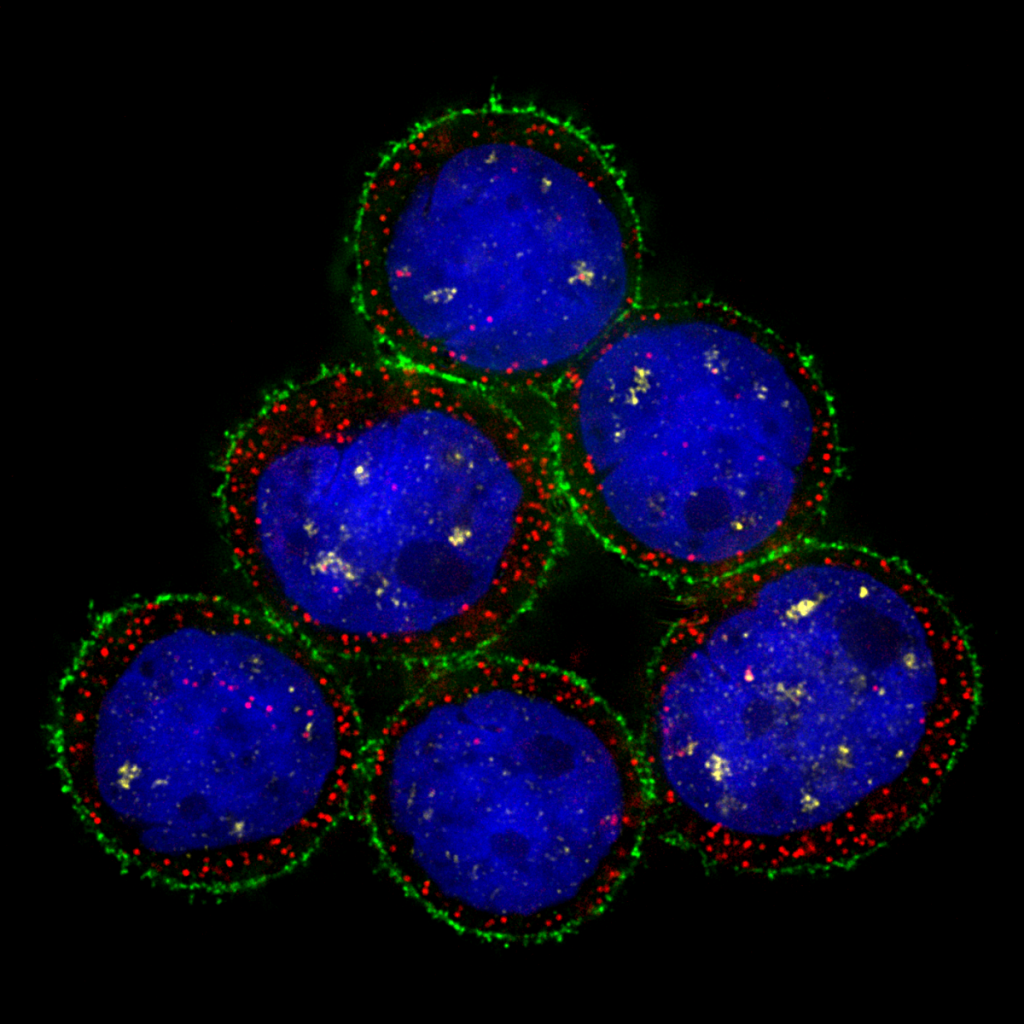 Image of the Month: Human breast cancer cells