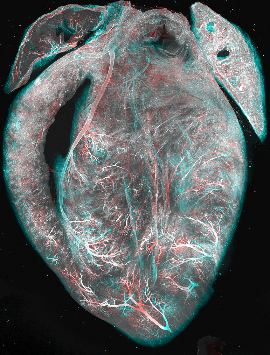 Image of the Month : A transparent heart