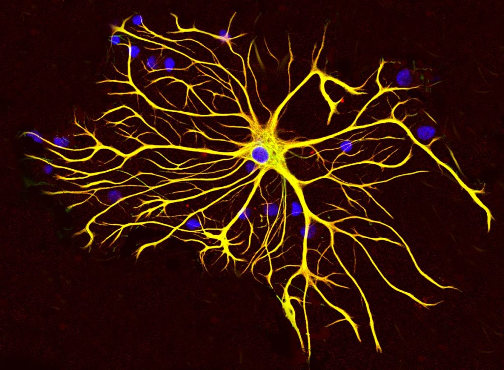Astrocytes Mediate Deficits In Learning And Memory Triggered By Social Isolation