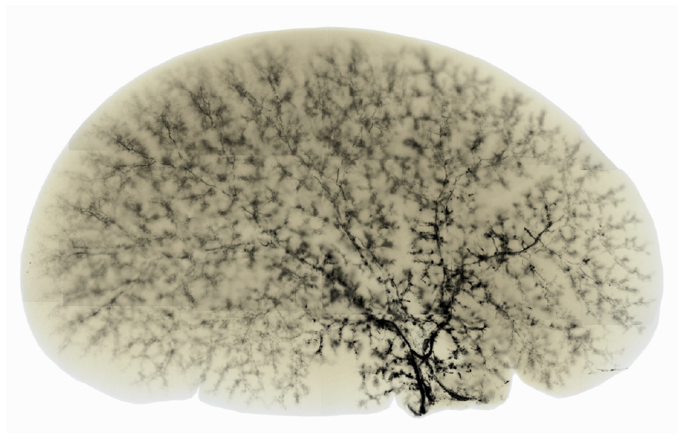 Image of the Month: The Liver's biliary tree