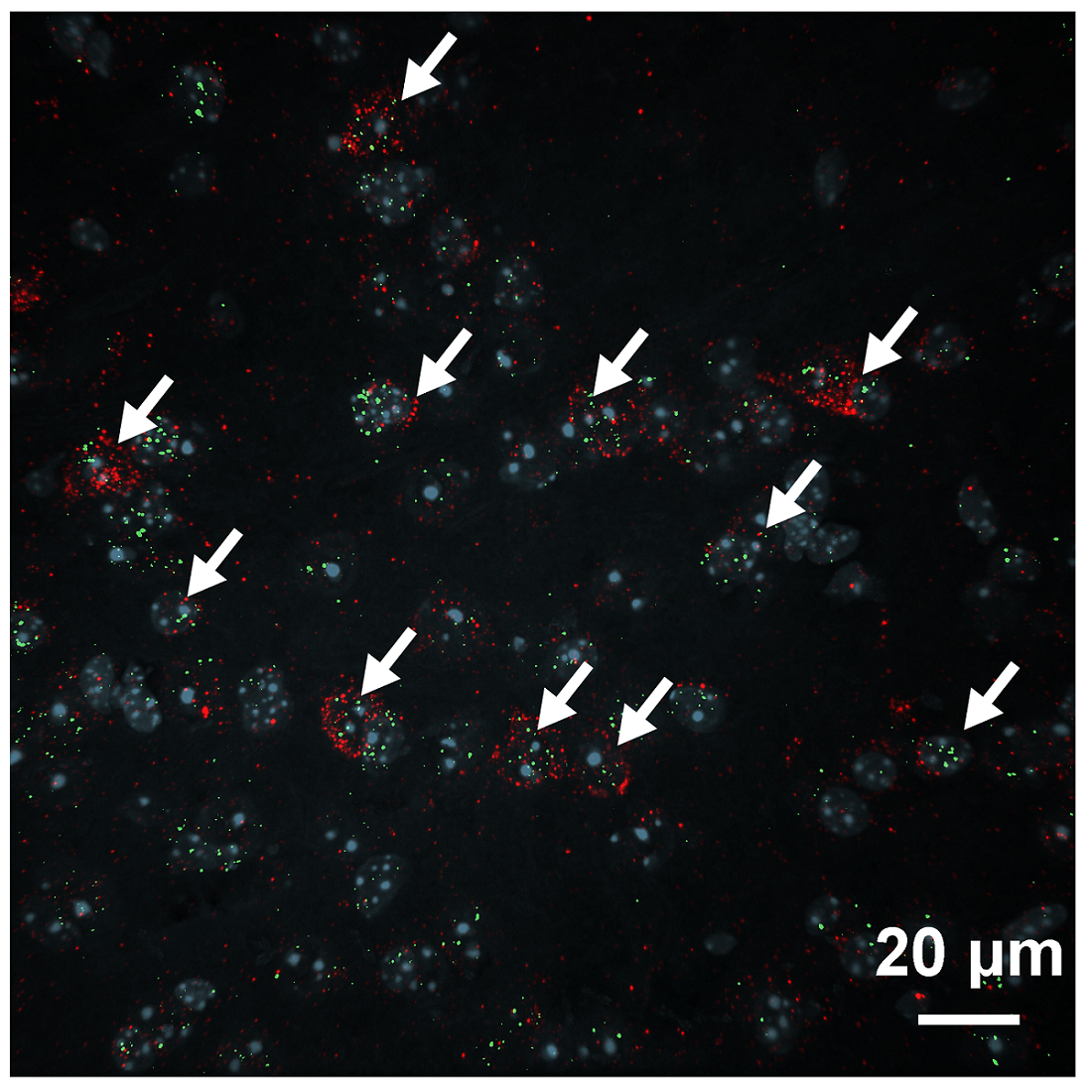 Low-glucose sensor in the brain promotes blood glucose balance