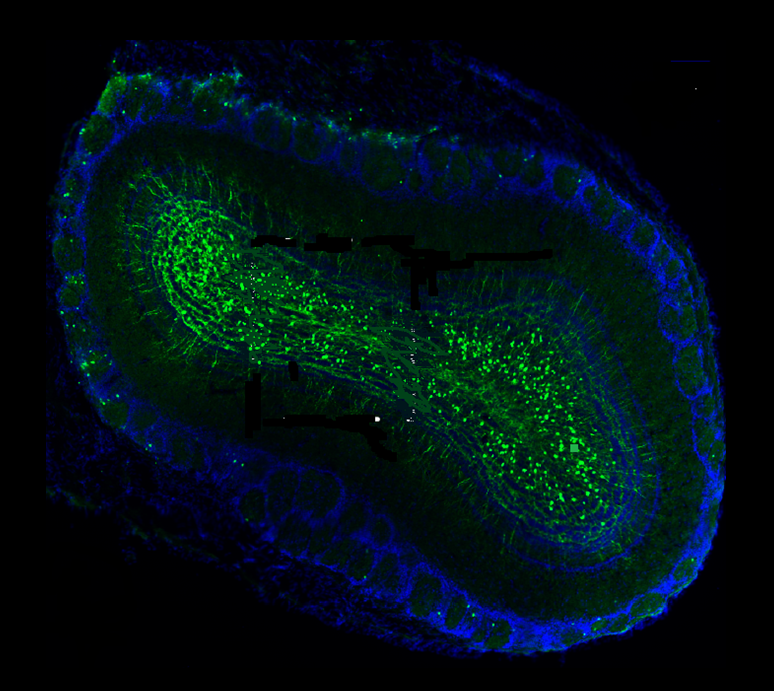 Image of the Month: Plasticity of adult-born neurons