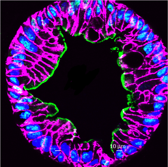 Image of the Month: Human intestinal enteroids