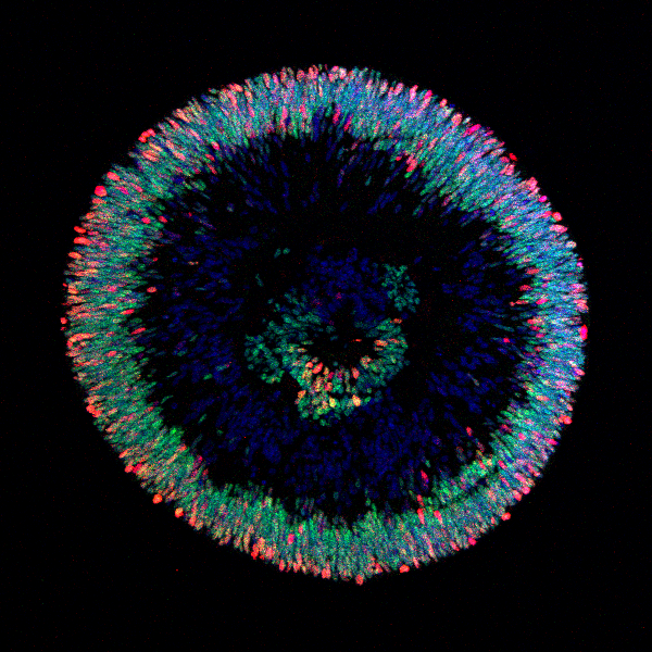 Image of the Month: Human retinal organoid
