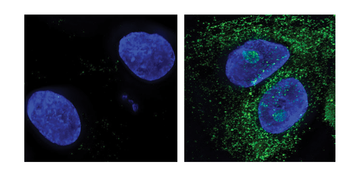 hnRNPM, a guardian of the integrity of cellular protein synthesis.