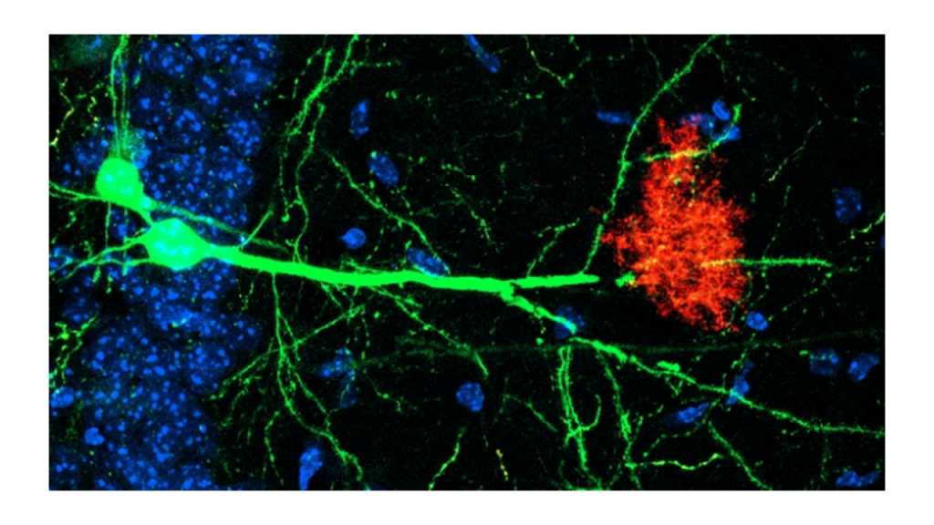 Image of the Month: Astrocytes, neurons and memory