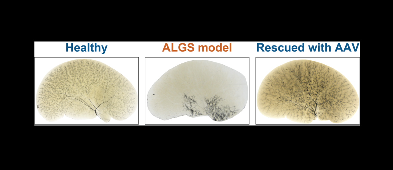 A new treatment can potentially change the outlook for patients with ...
