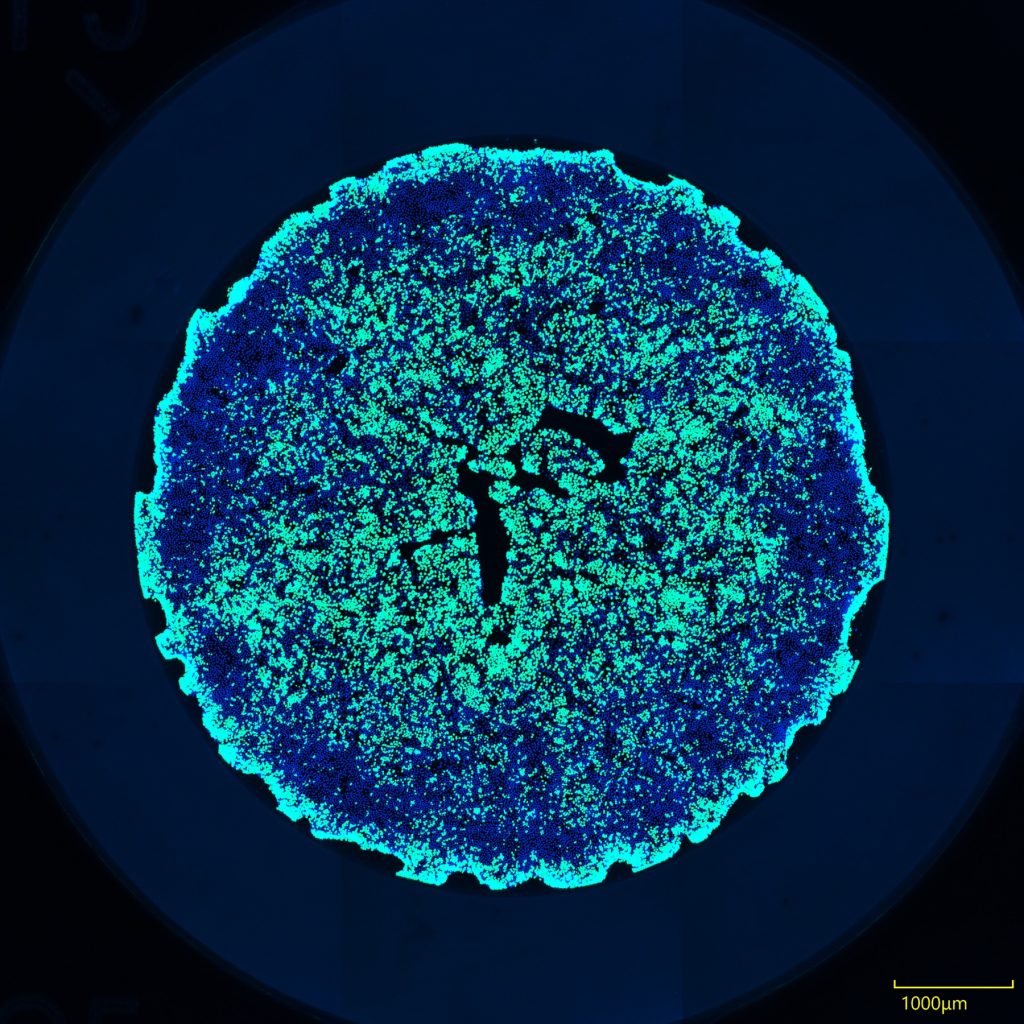 Image of the Month: Human intestinal organoid