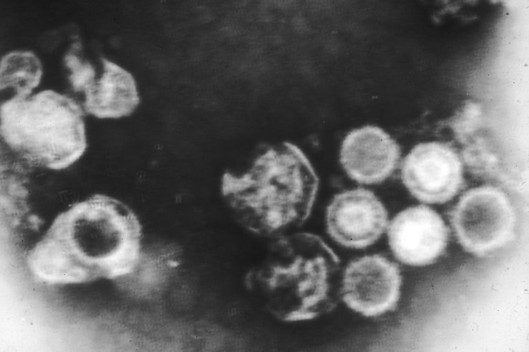 These 22 genes could put people at risk of long-term health conditions ...
